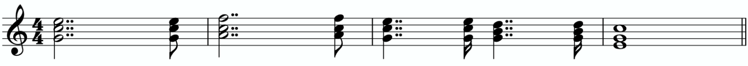 The Difference Between Dots in Music – Liberty Park Music